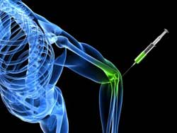 Platelet Rich Plasma (PRP) | Article | TPI